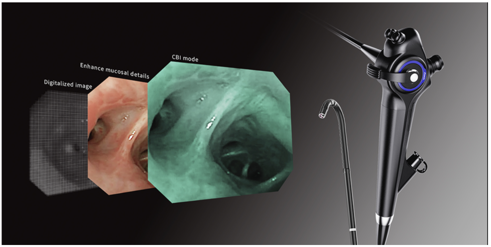 Broncoscopio / Video Broncoscopio AOHUA AQ-100 | Mpmedical